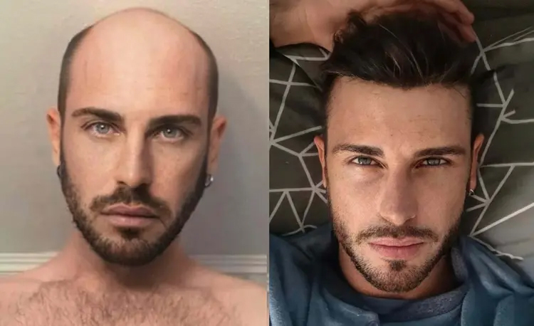 Complément Capillaire Indéctable | Lordhair